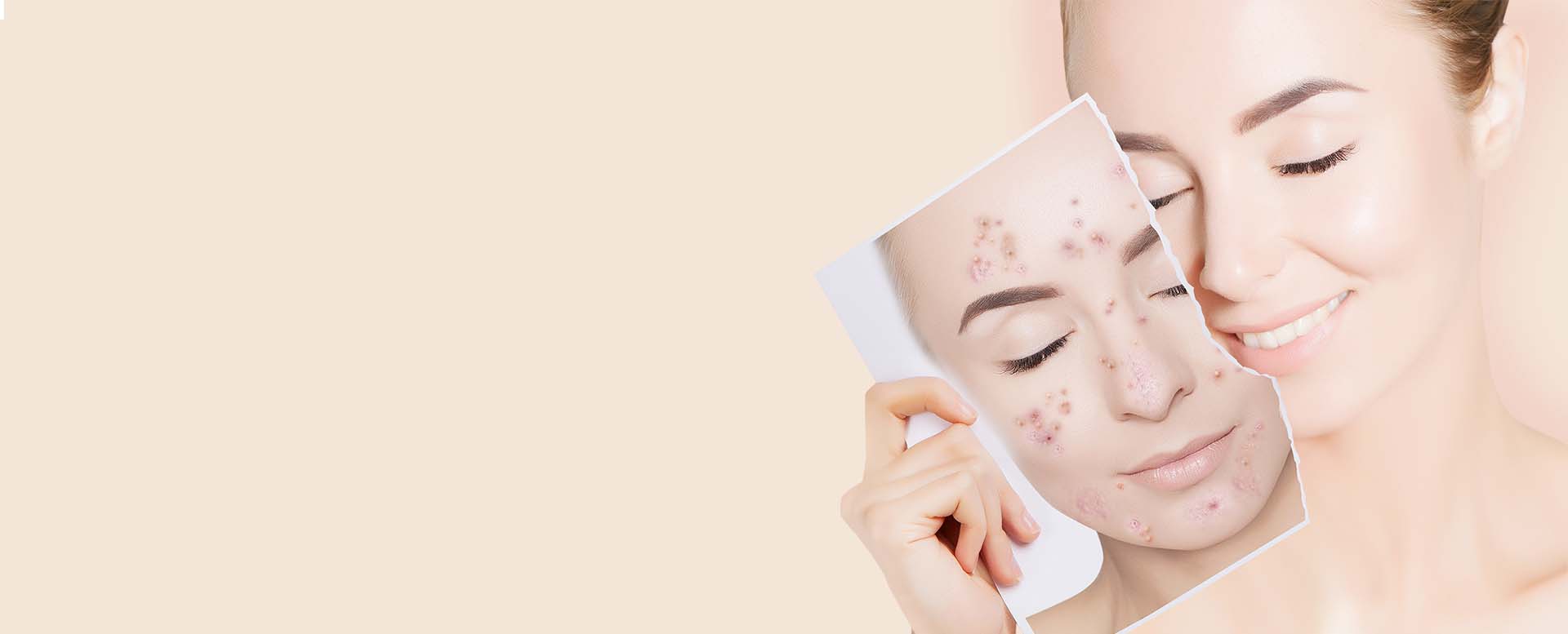 Best Skin Care Clinic in Gurgaon | Best Dermatologiest in Sec 53