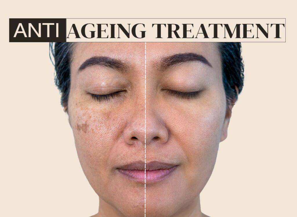 Anti Ageing Treatment - Skin Lattice